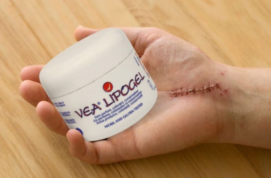 Les 4 phases de cicatrisation d'une plaie